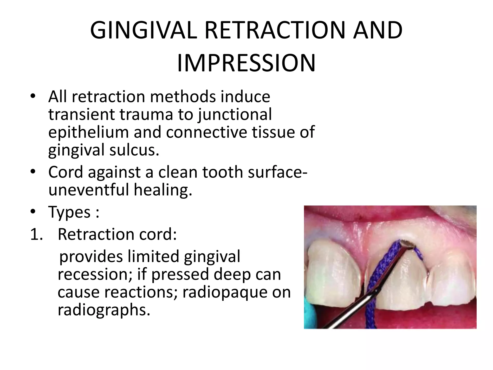 Fixed prosthodontics with periodontally compromised dentition | PPTX