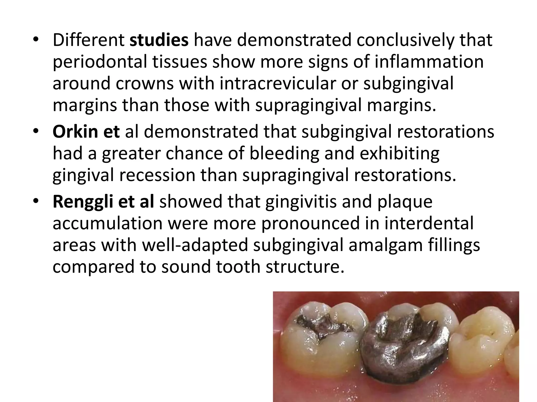 Fixed prosthodontics with periodontally compromised dentition | PPTX