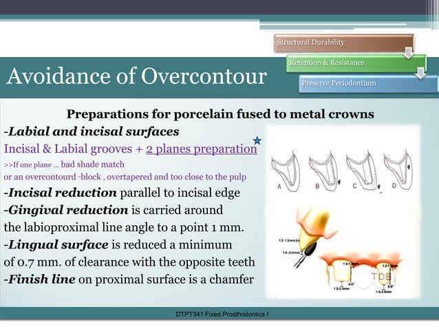 Fixed prosth problem based learning | PPT