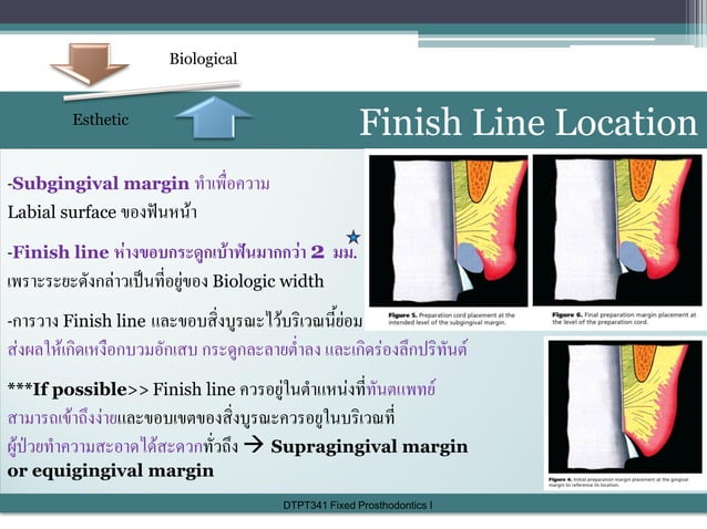 Fixed prosth problem based learning | PPT