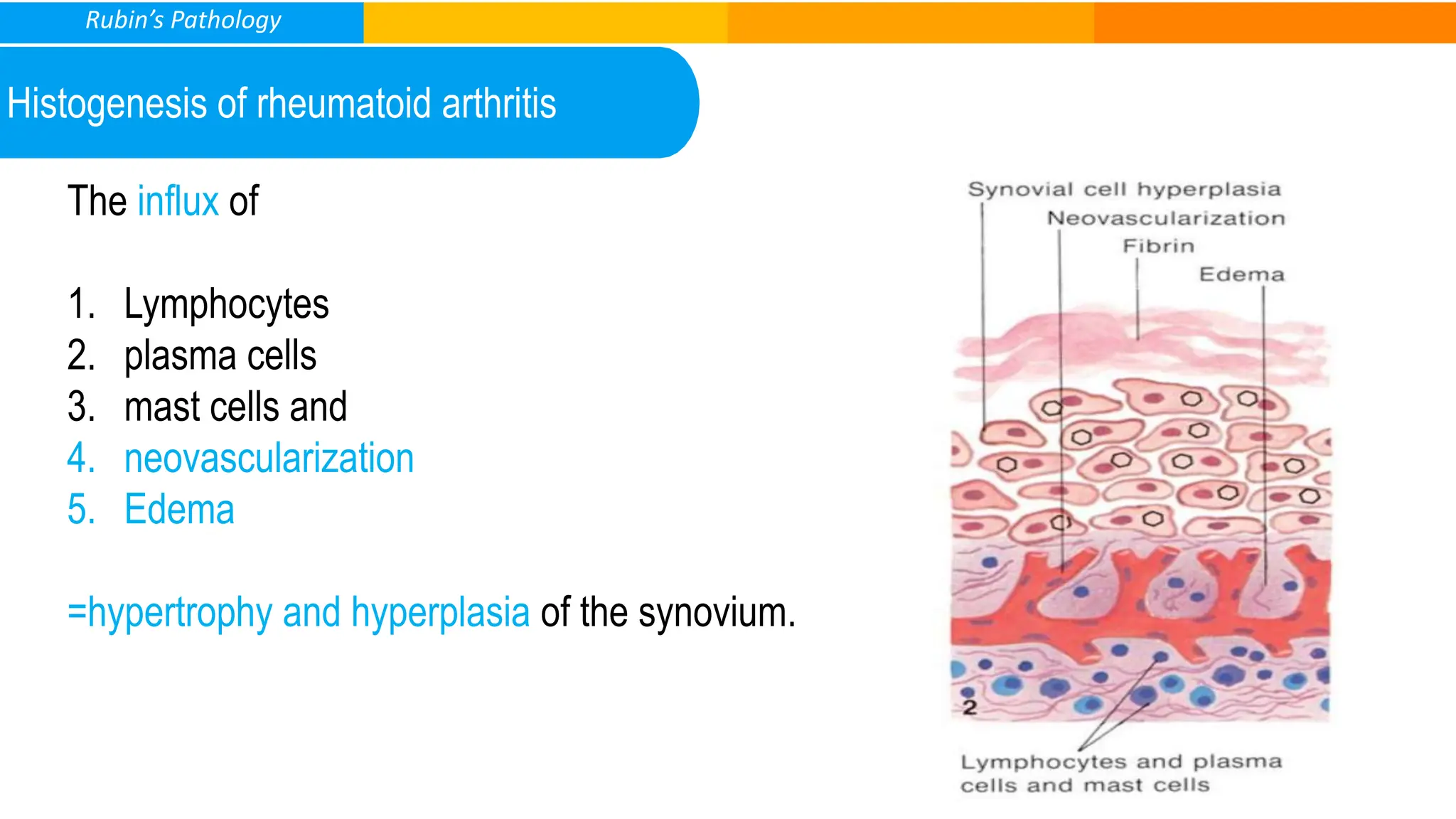 Histopathology of Rheumatoid Arthritis: Visual treat | PPTX