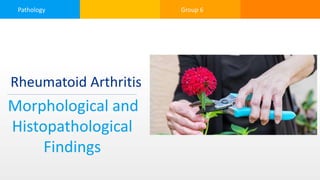 Histopathology of Rheumatoid Arthritis: Visual treat | PPT