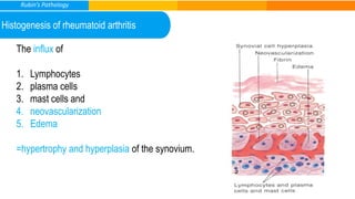 Histopathology of Rheumatoid Arthritis: Visual treat | PPT