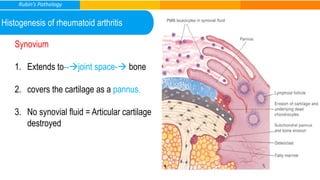 Histopathology of Rheumatoid Arthritis: Visual treat | PPT