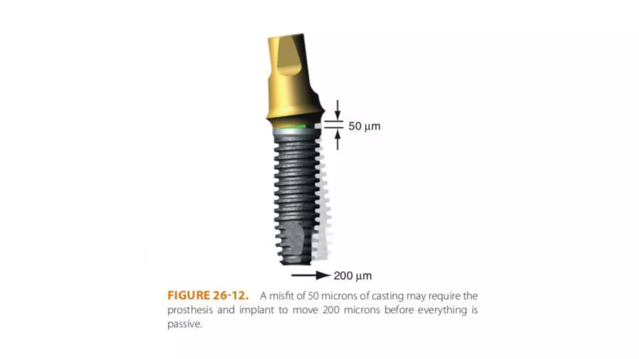 Principles of Fixed Implant prosthetics | PPTX