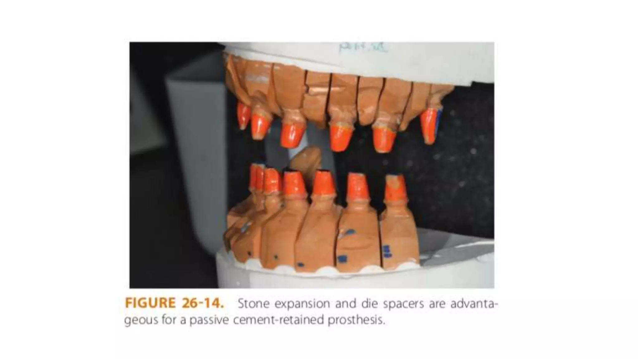 Principles of Fixed Implant prosthetics | PPTX