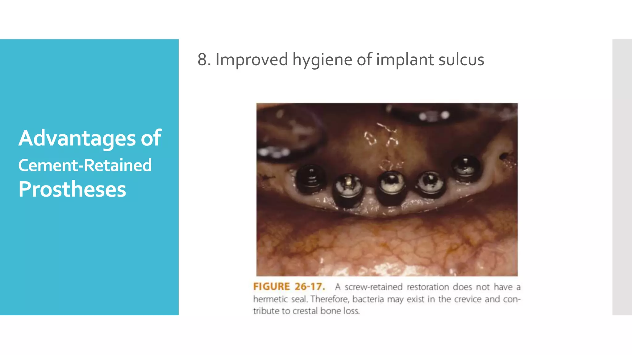 Principles of Fixed Implant prosthetics | PPTX