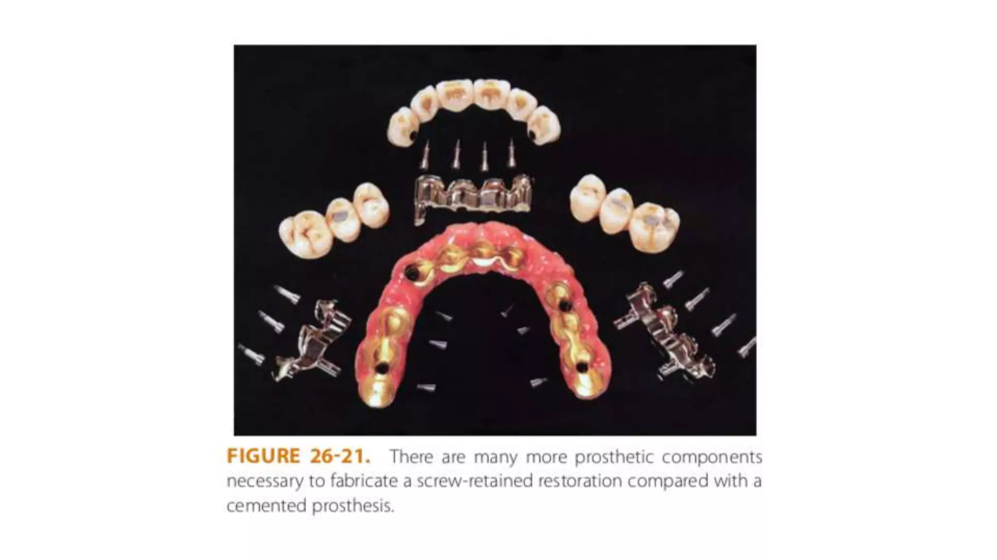 Principles of Fixed Implant prosthetics | PPTX