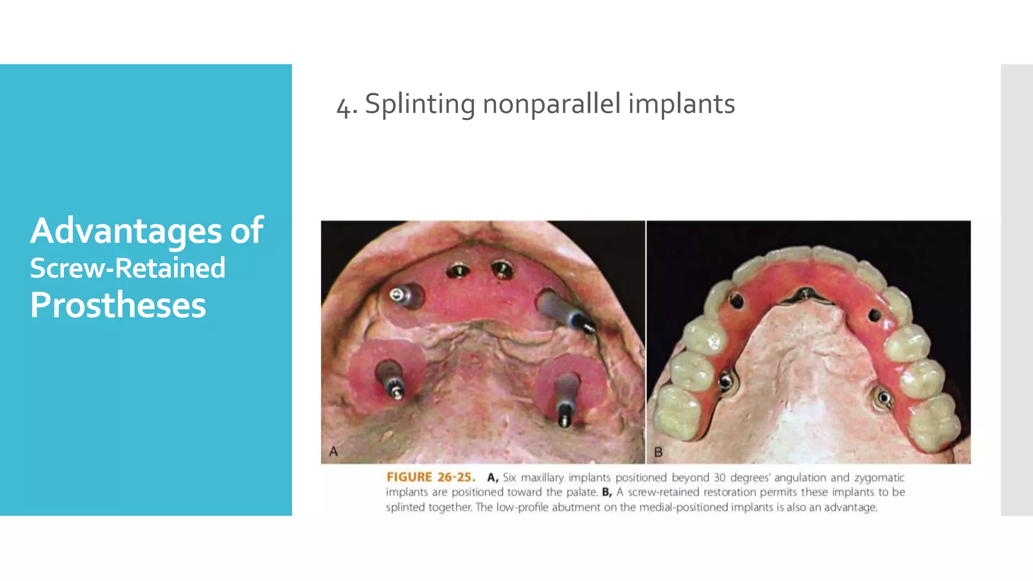 Principles of Fixed Implant prosthetics | PPTX