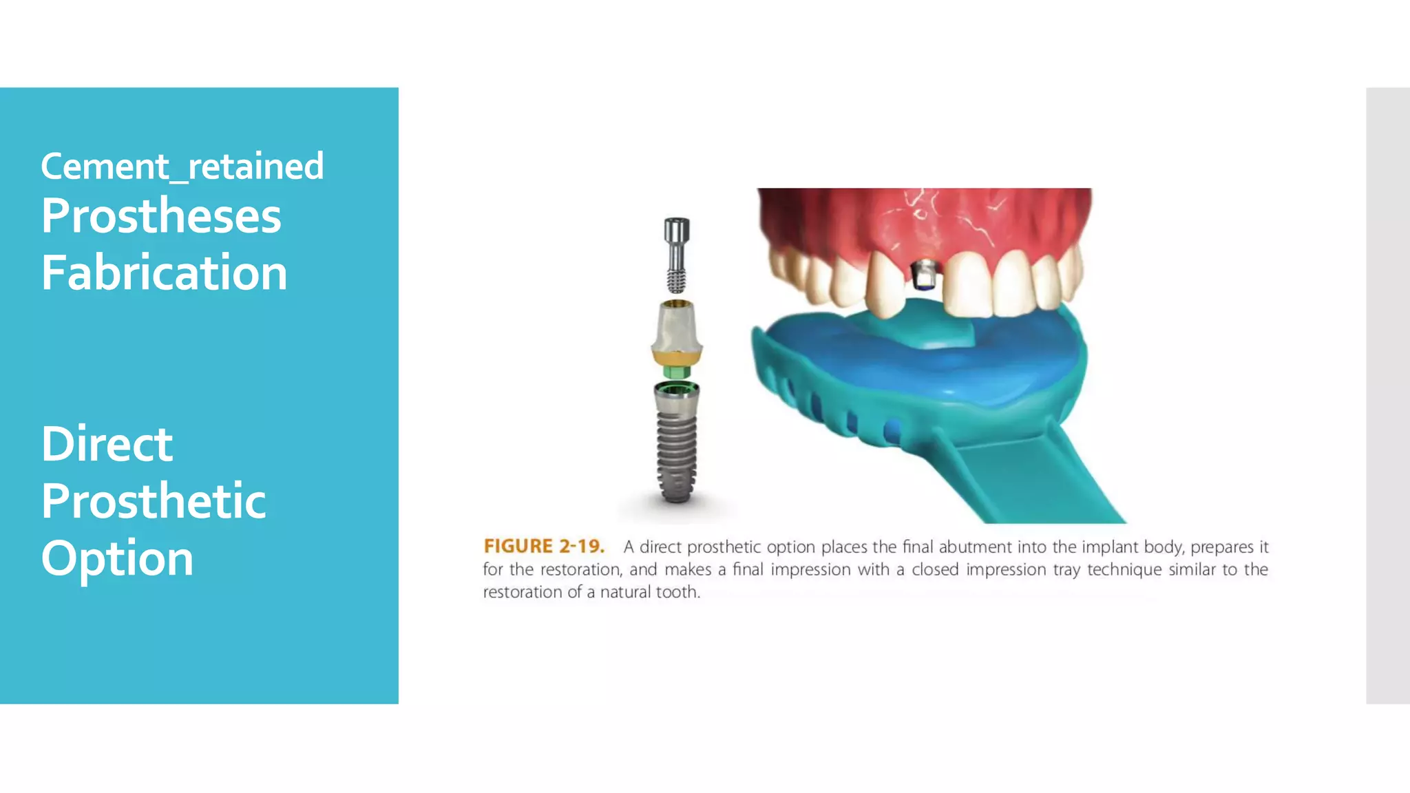 Principles of Fixed Implant prosthetics | PPTX