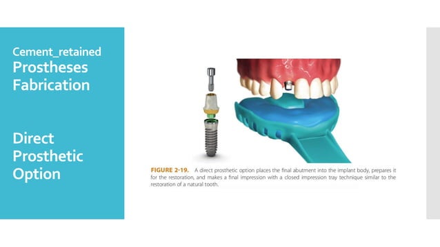 Principles of Fixed Implant prosthetics | PPTX