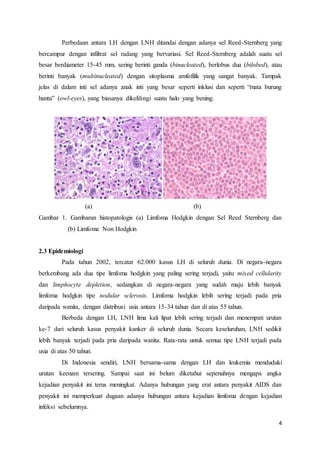 Asuhan Keperawatan Limfoma Maligna | DOCX
