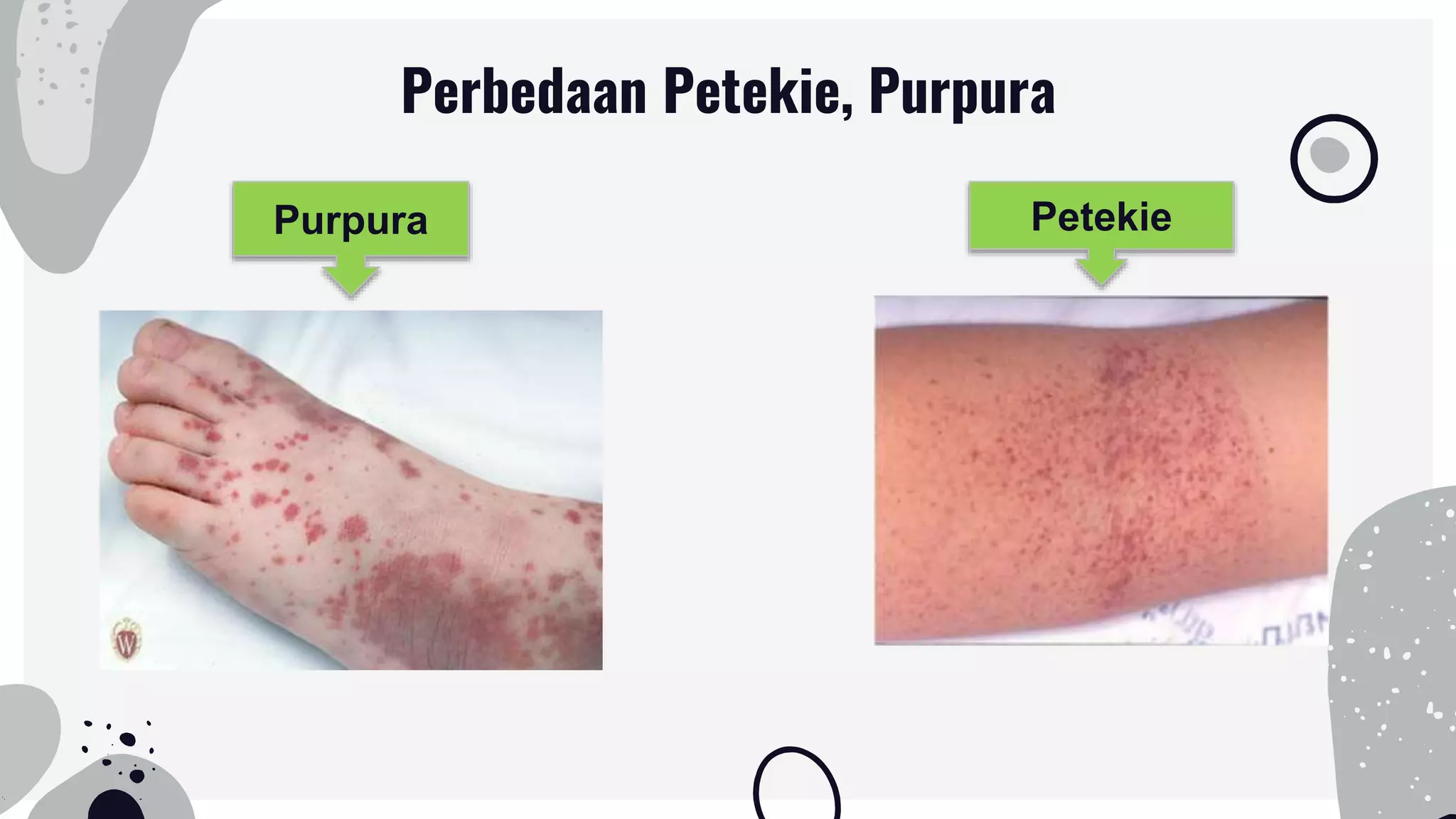 FIX PPT LAPKAS RIZKI (HSP).pptx