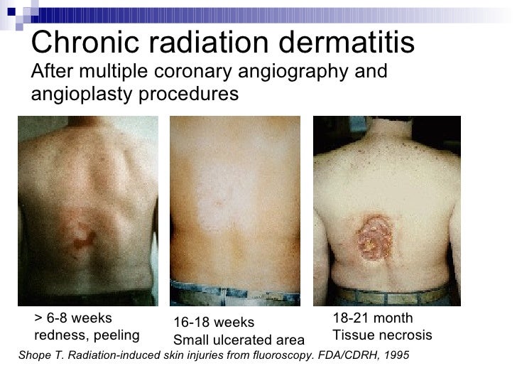 Fizik master-radyobiyoloji 1