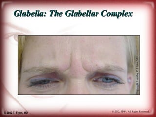 Facial Aging Process and Anatomy | PPT