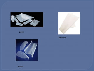 CON-CHEST_WALL_RECONSTRUCTION-2023.pptx