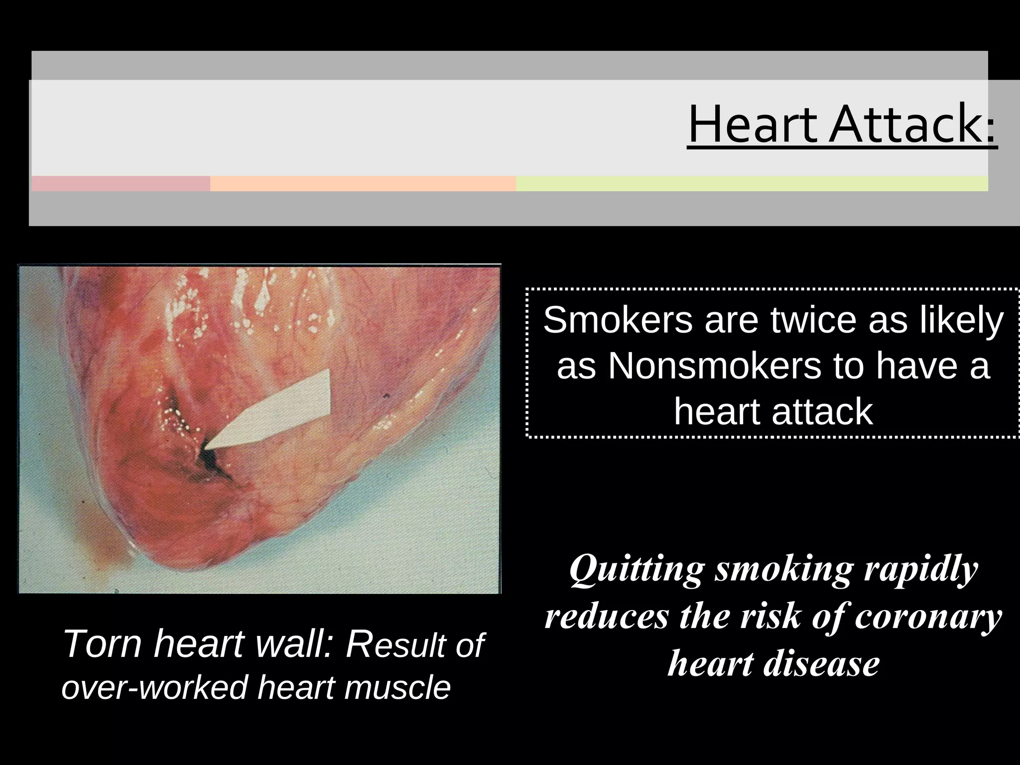 quitsmoking pitch | PPT