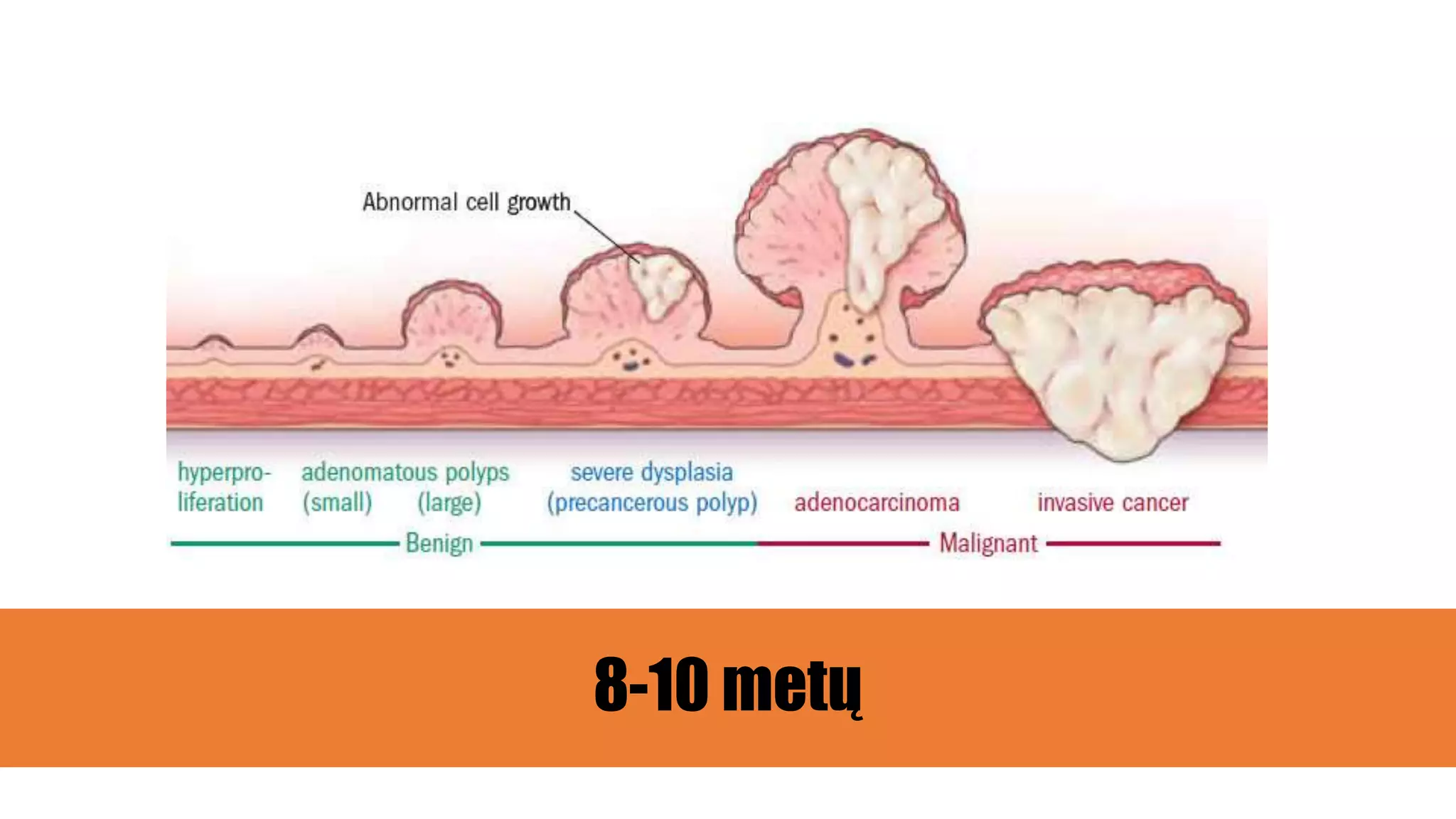 Colon prep for colonoscopy | PPTX