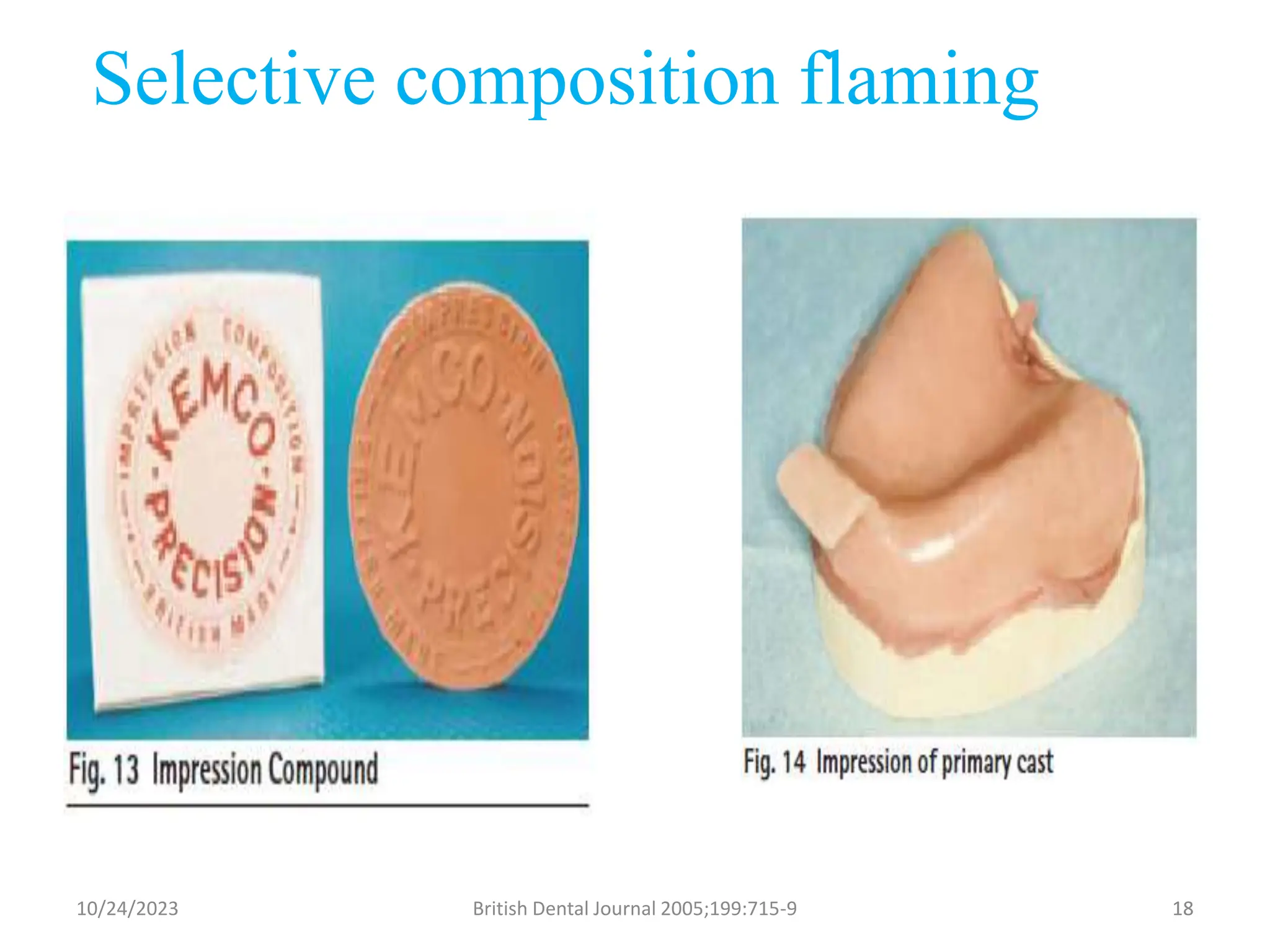 Journal club on Management of flabby ridges | PPTX