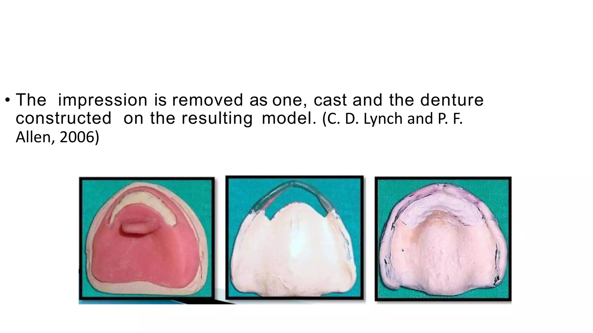 MANAGEMENT OF SEVERELY RESORBED RIDGES | PPTX