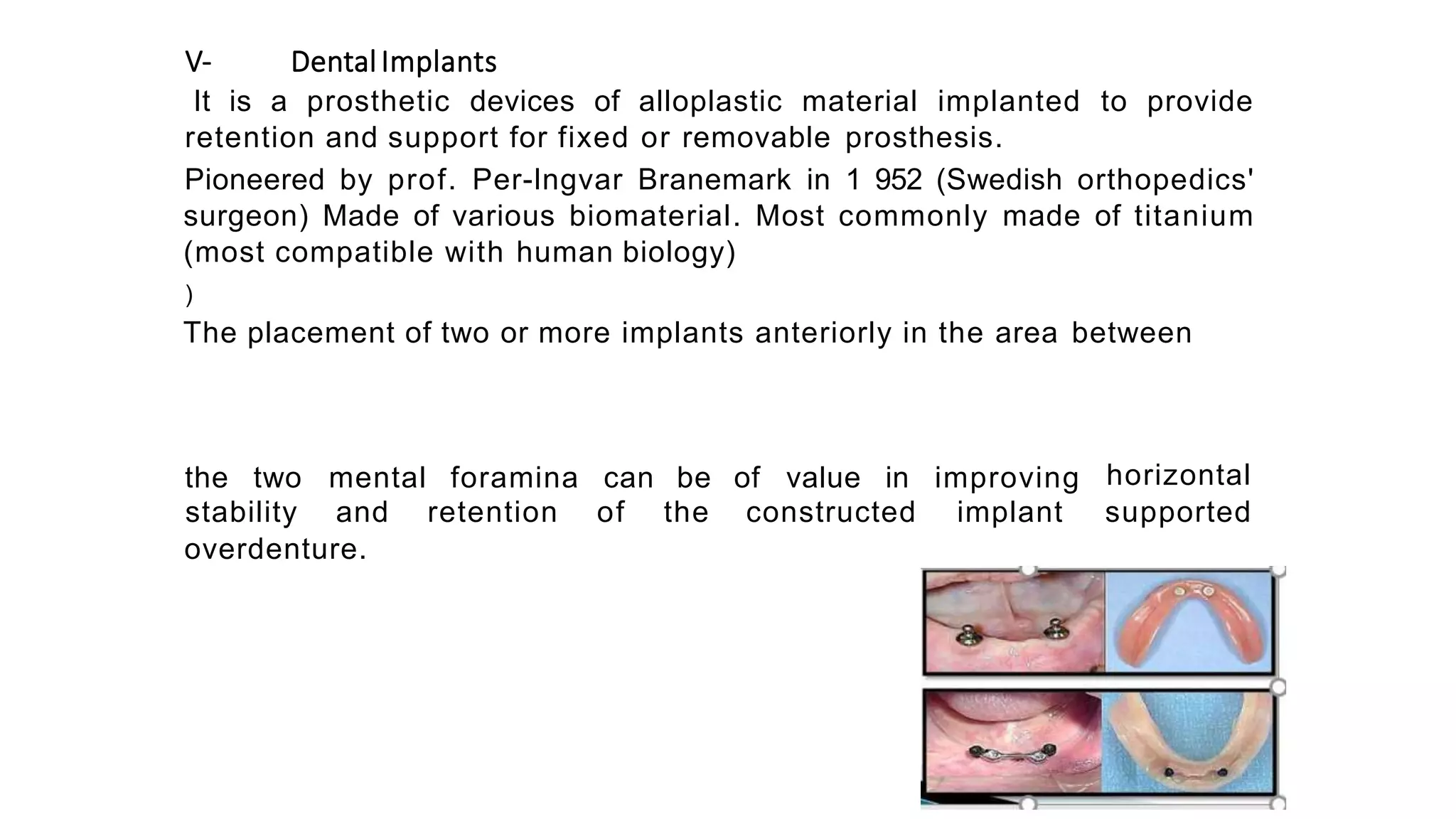 MANAGEMENT OF SEVERELY RESORBED RIDGES | PPTX
