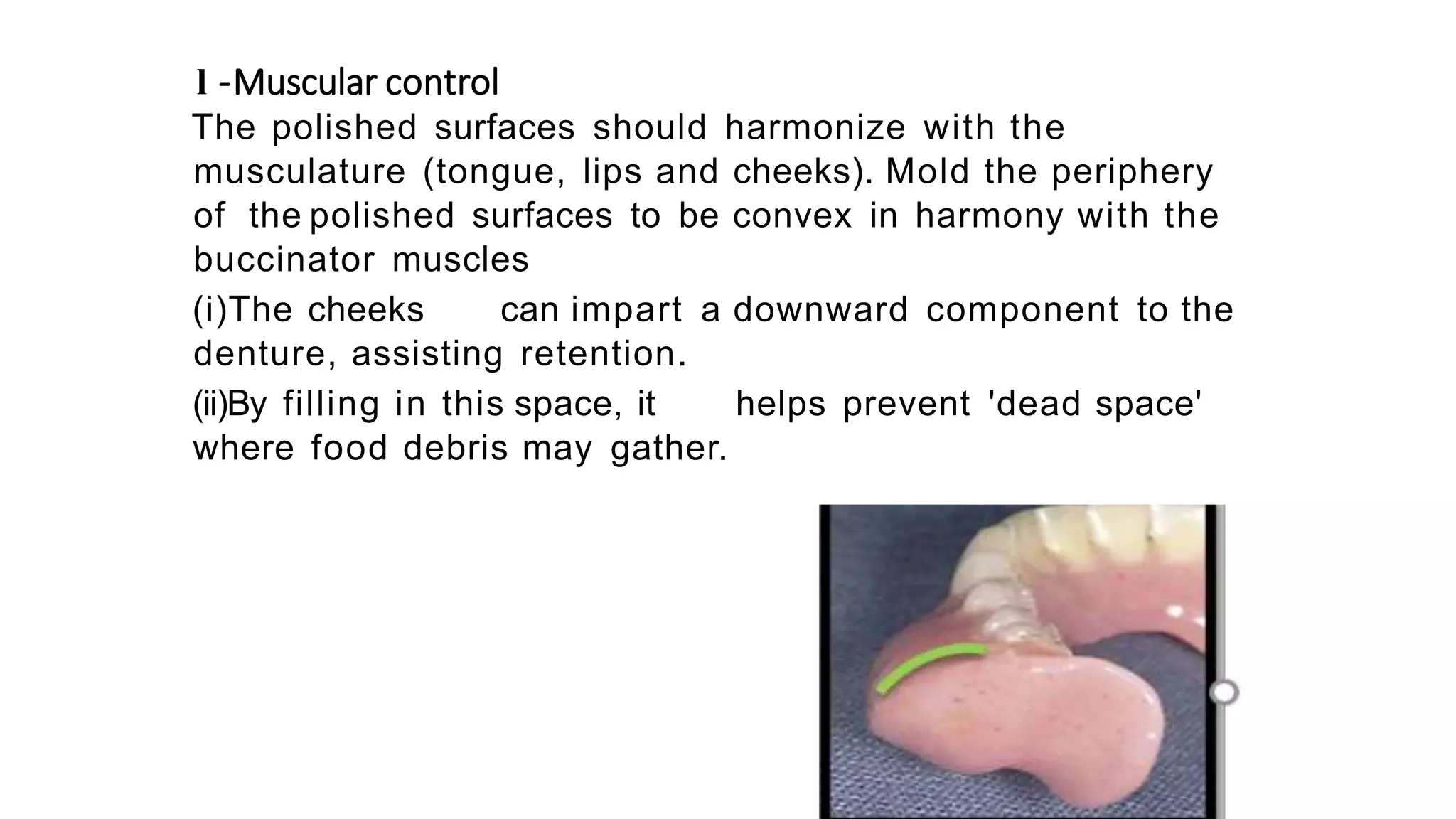 MANAGEMENT OF SEVERELY RESORBED RIDGES | PPTX