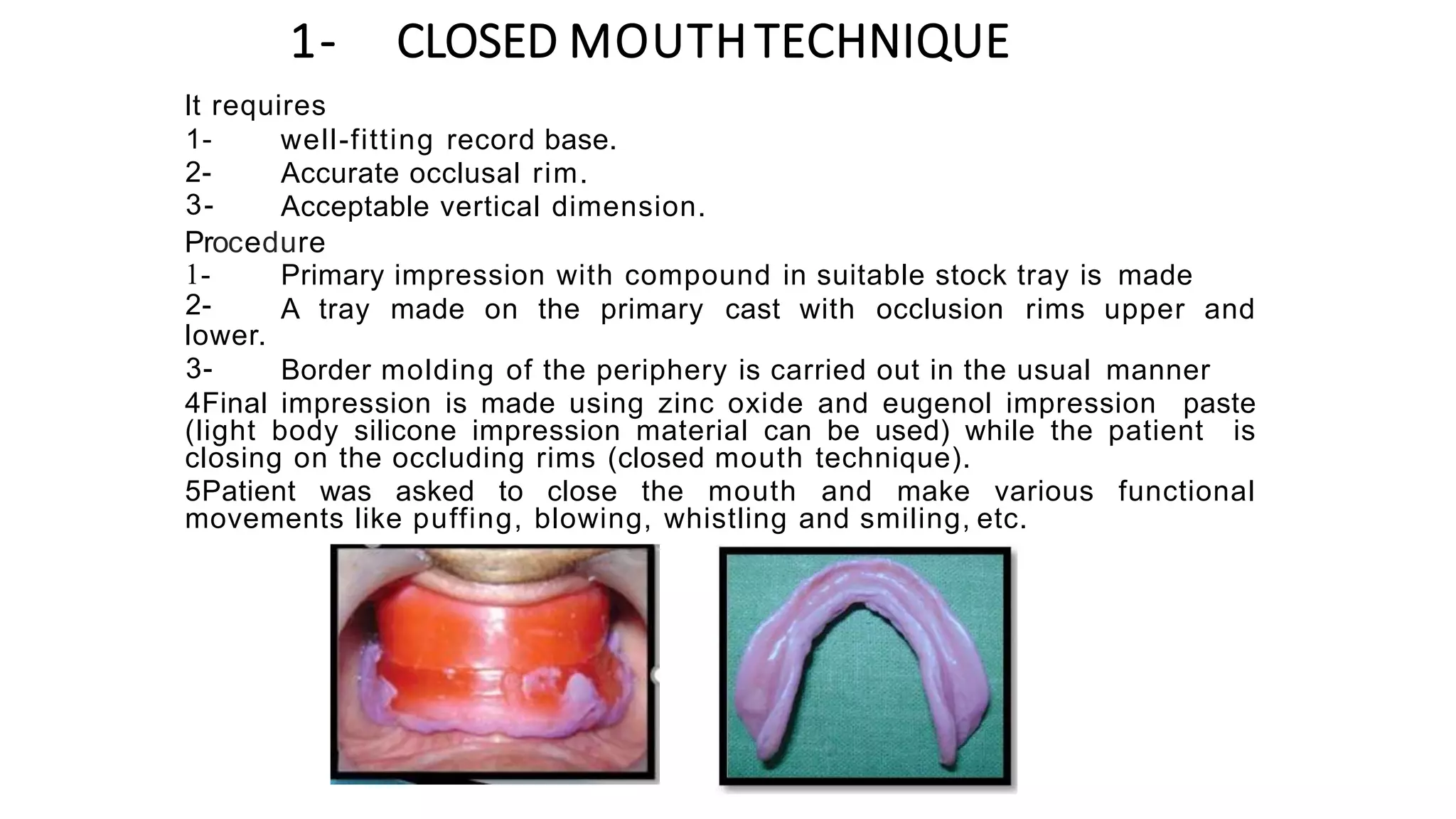 MANAGEMENT OF SEVERELY RESORBED RIDGES | PPTX