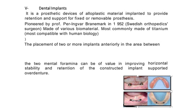 MANAGEMENT OF SEVERELY RESORBED RIDGES | PPTX