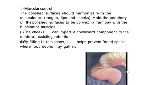 MANAGEMENT OF SEVERELY RESORBED RIDGES | PPTX