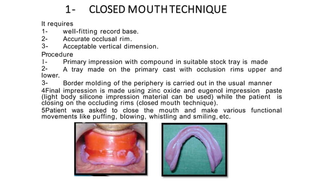 MANAGEMENT OF SEVERELY RESORBED RIDGES | PPTX