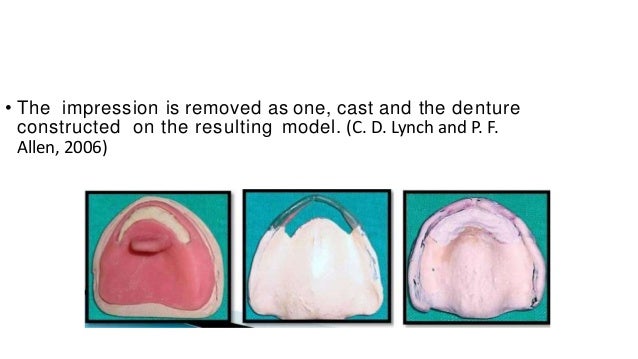 MANAGEMENT OF SEVERELY RESORBED RIDGES