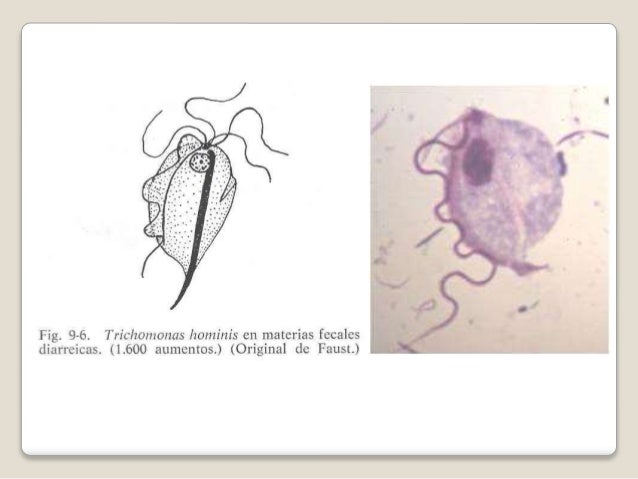 Flagelados intestinales