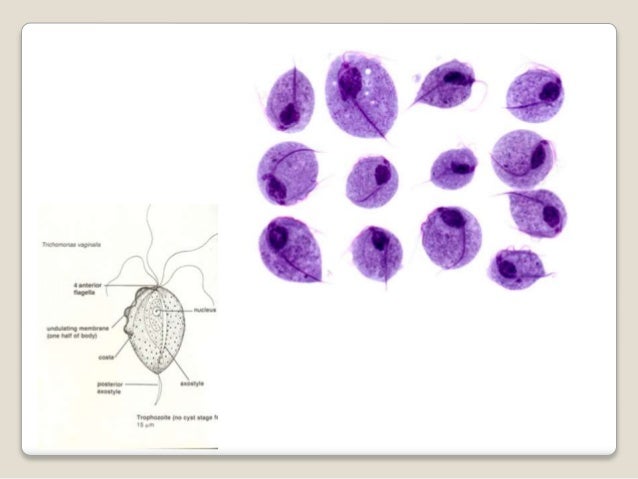 Flagelados intestinales