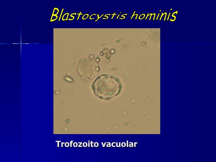 Flagelasdos, ciliados y practica 3 y 4
