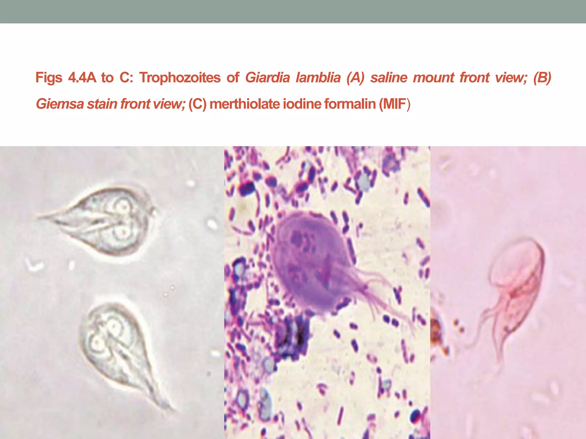 Flagellates—I (Intestinal and Genital). lecture 5 chapter 4 pptx.pptx ...