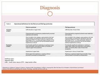 Flail Arm Syndrome: An Atypical Variant of Motor Neuron Disease | PPT