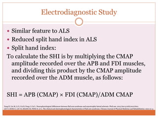 Flail Arm Syndrome: An Atypical Variant of Motor Neuron Disease | PPT