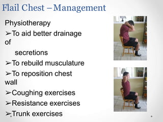 flailchest-140501045412-phpapp01.pptx