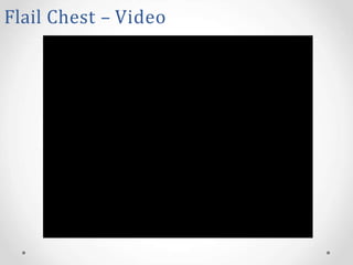 flailchest-140501045412-phpapp01.pptx