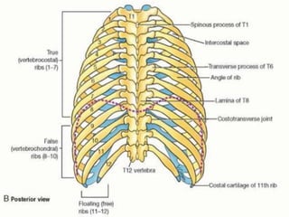 Vertebrocostal Ribs