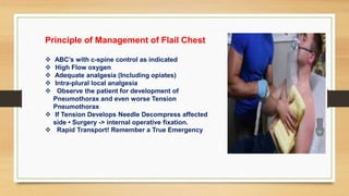 Flail chest | PPTX