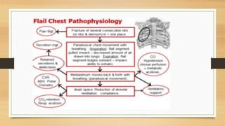 Flail chest | PPTX