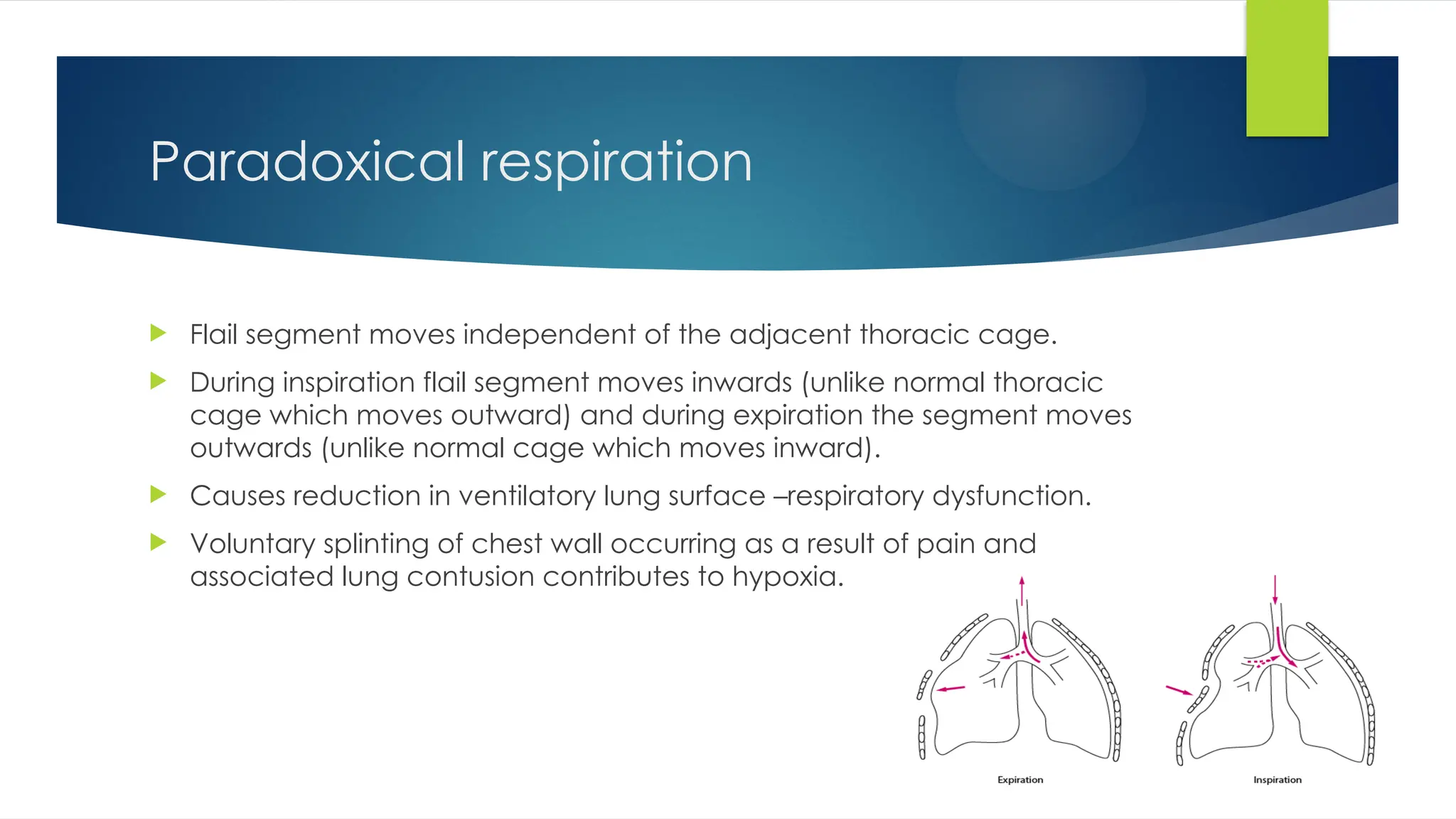 FLAIL CHEST.pptx surgery trauma , thoracic injury | PPT