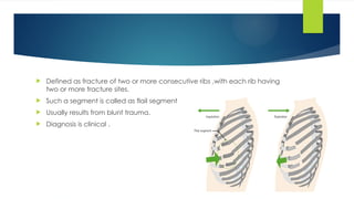 FLAIL CHEST.pptx surgery trauma , thoracic injury | PPT