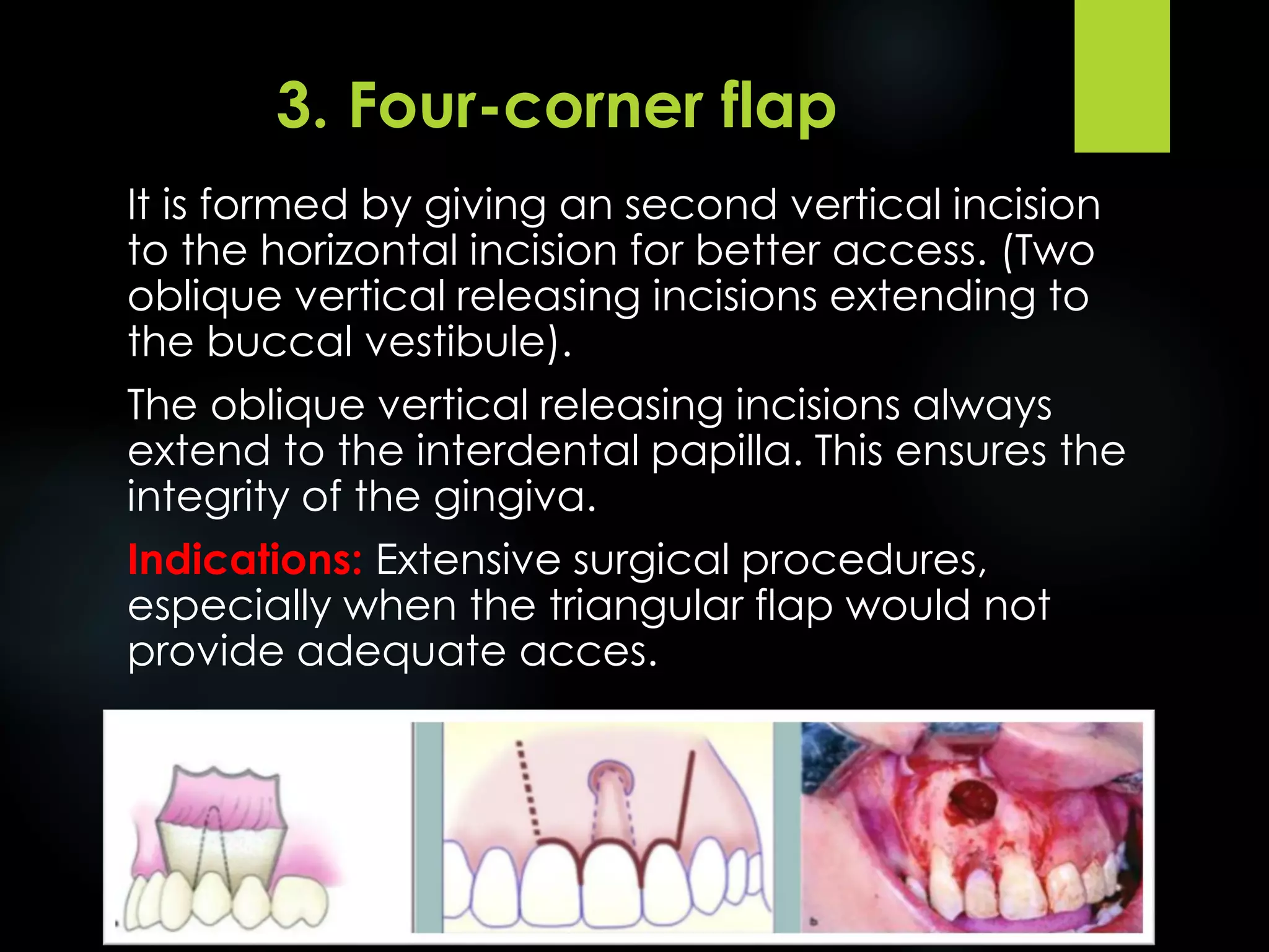 Flap Design for Minor Oral Surgery | PDF