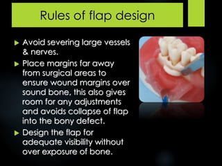 Flap Design for Minor Oral Surgery | PDF