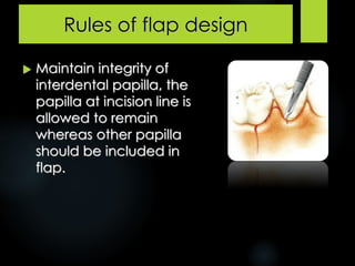 Flap Design for Minor Oral Surgery | PDF