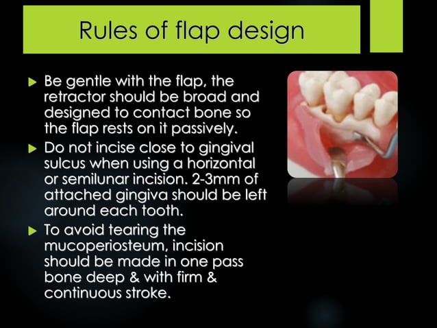 Flap Design for Minor Oral Surgery | PDF | Dental Health | Diseases and ...
