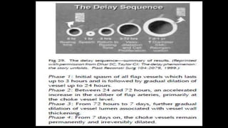 Flap-Delay-Phenomena.pptx