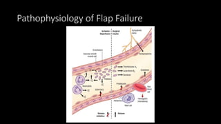 Flap-Delay-Phenomena.pptx